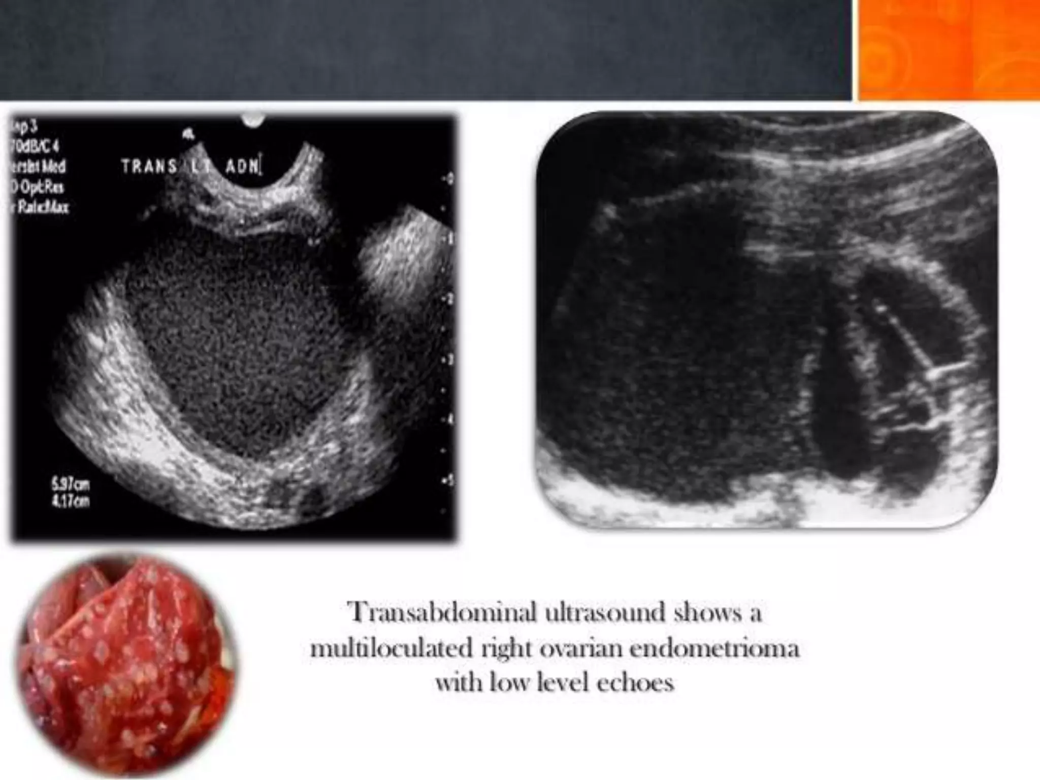 Basic gynae ultrasound | PPTX