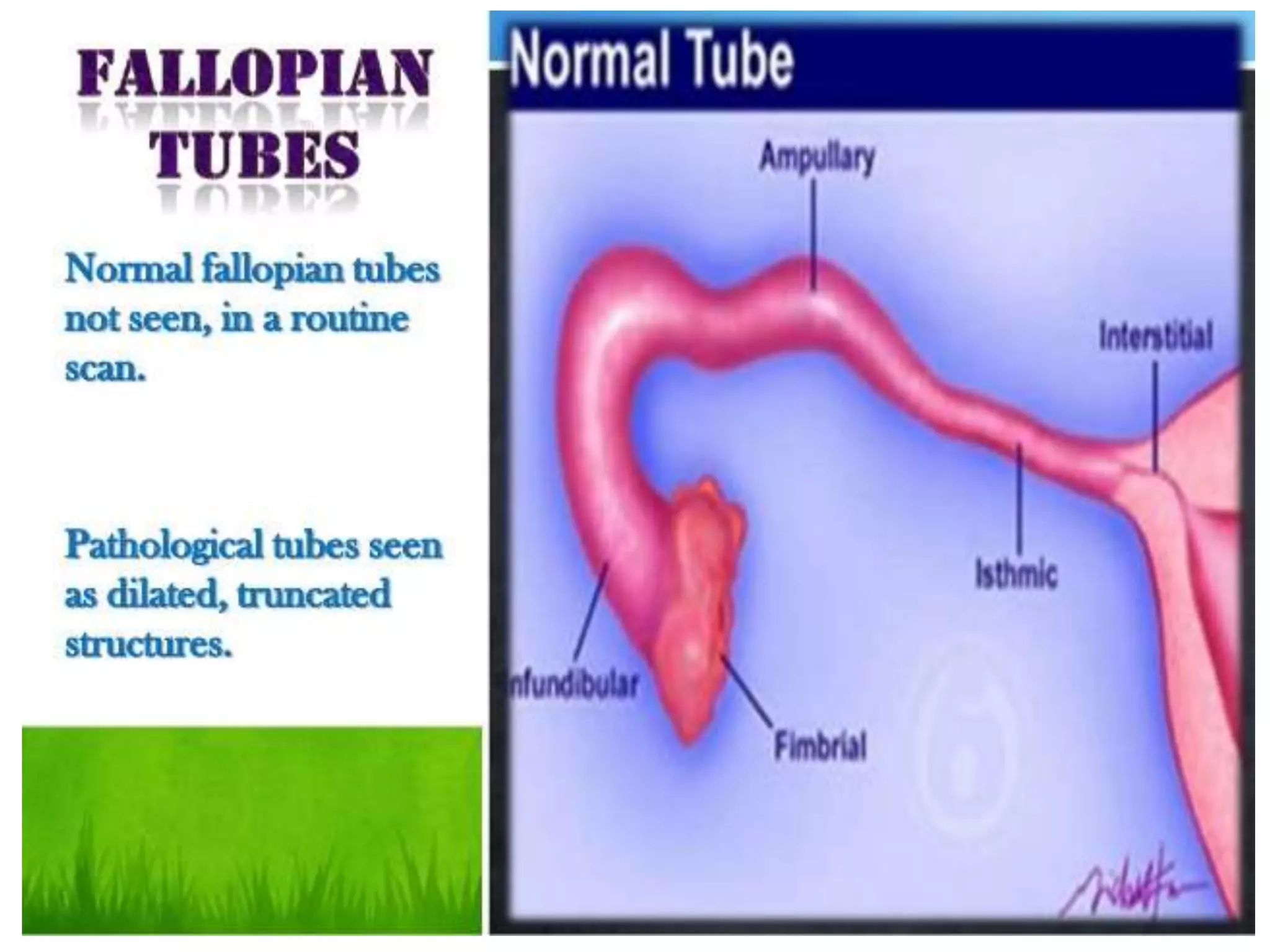 Basic gynae ultrasound | PPTX