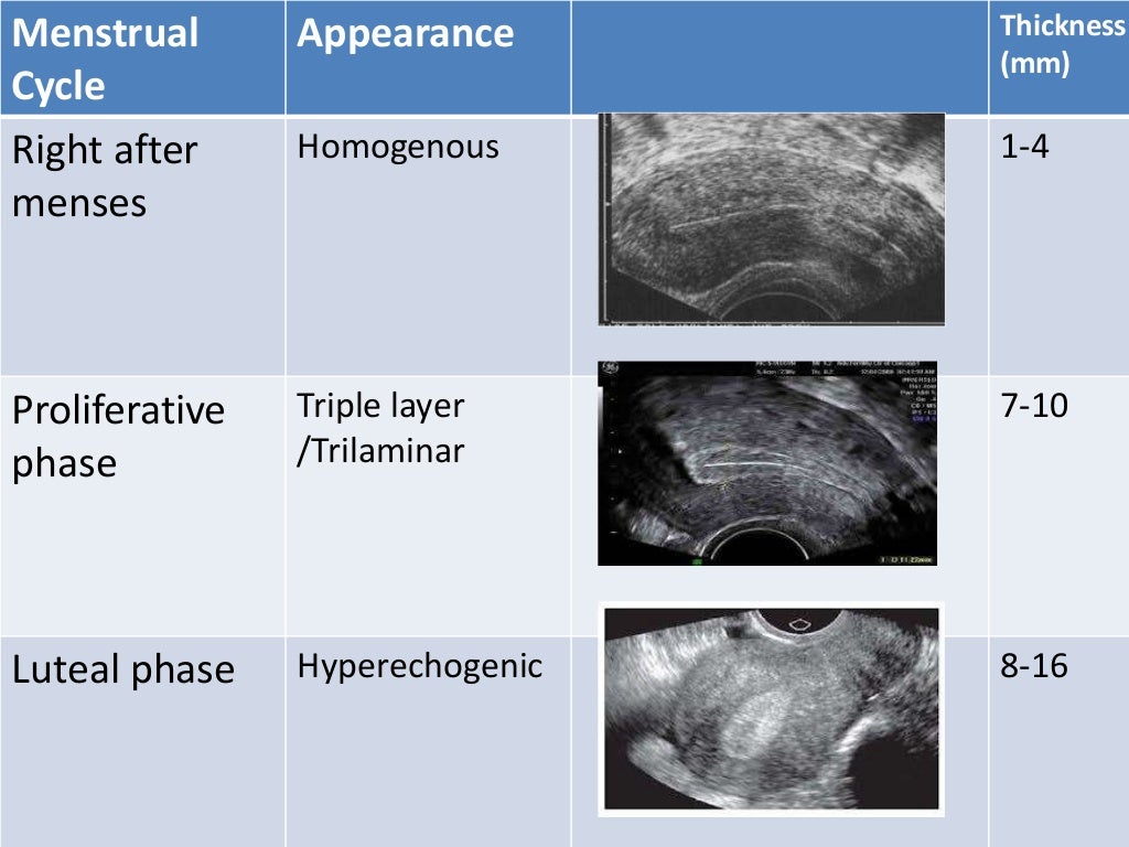 Basic gynae ultrasound