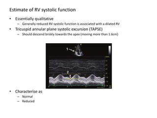 Basic haemodynamic assessment with echo (iHeartScan) | PPTX