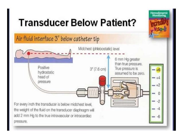 Basic haemodynamic monitoring