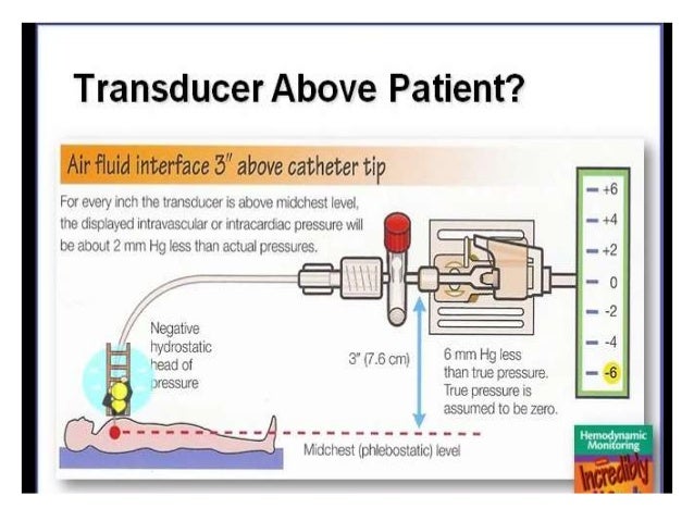 Basic haemodynamic monitoring