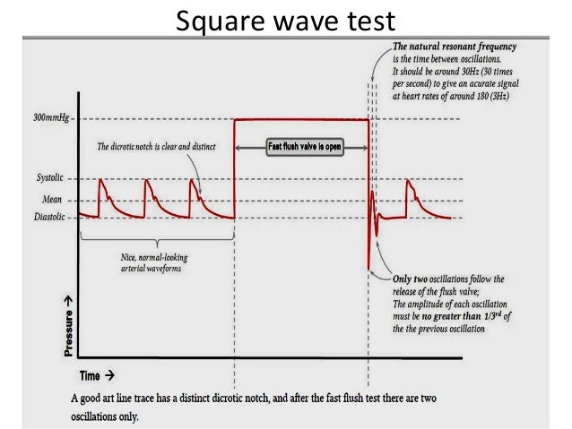 Basic haemodynamic monitoring
