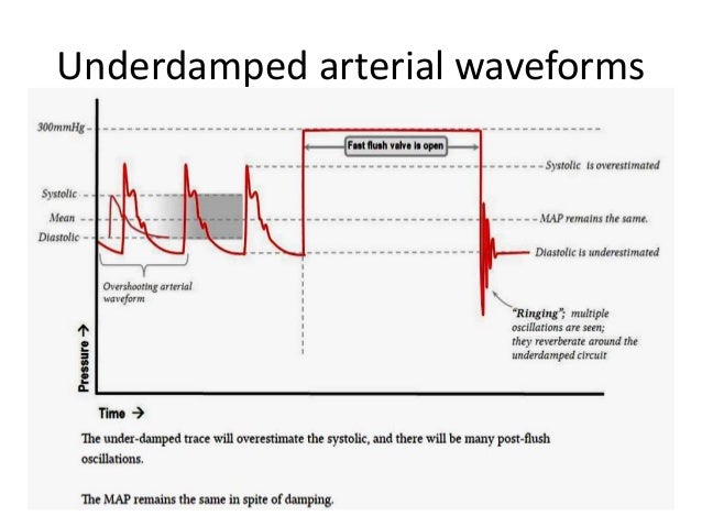 Basic haemodynamic monitoring