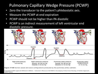 Basic hemodynamic monitoring for nurses | PPT