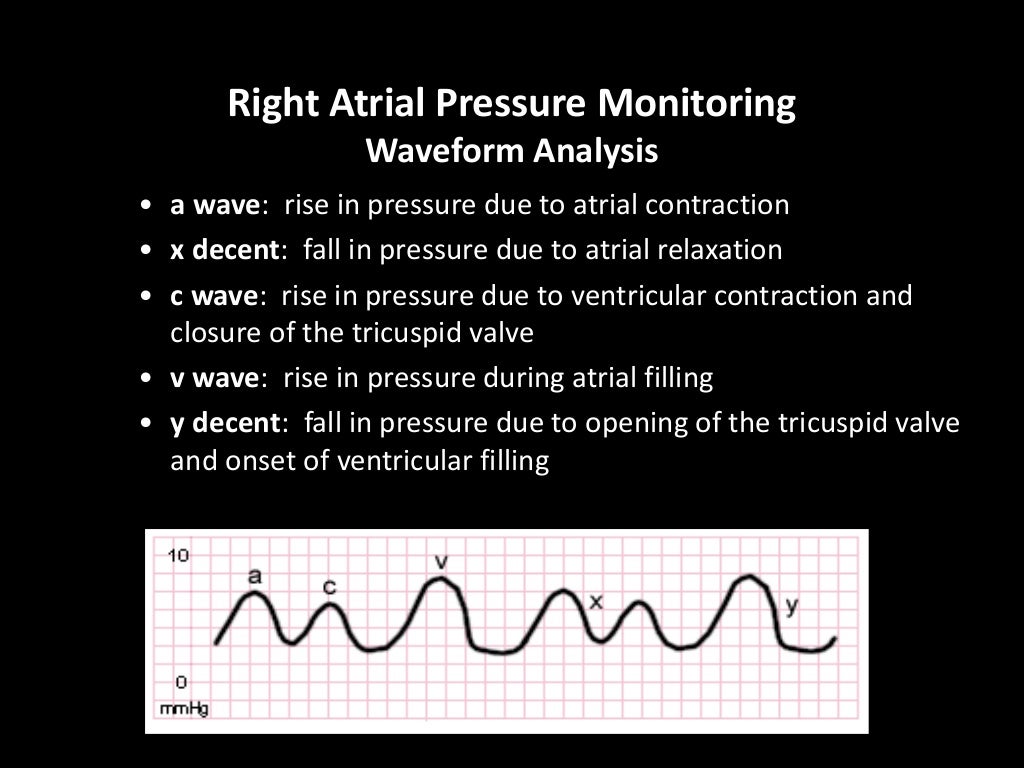 Hemodynamic Monitoring Explained At Benjamin Hutchison Blog