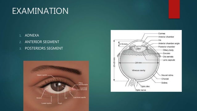 Basic history and eye examination