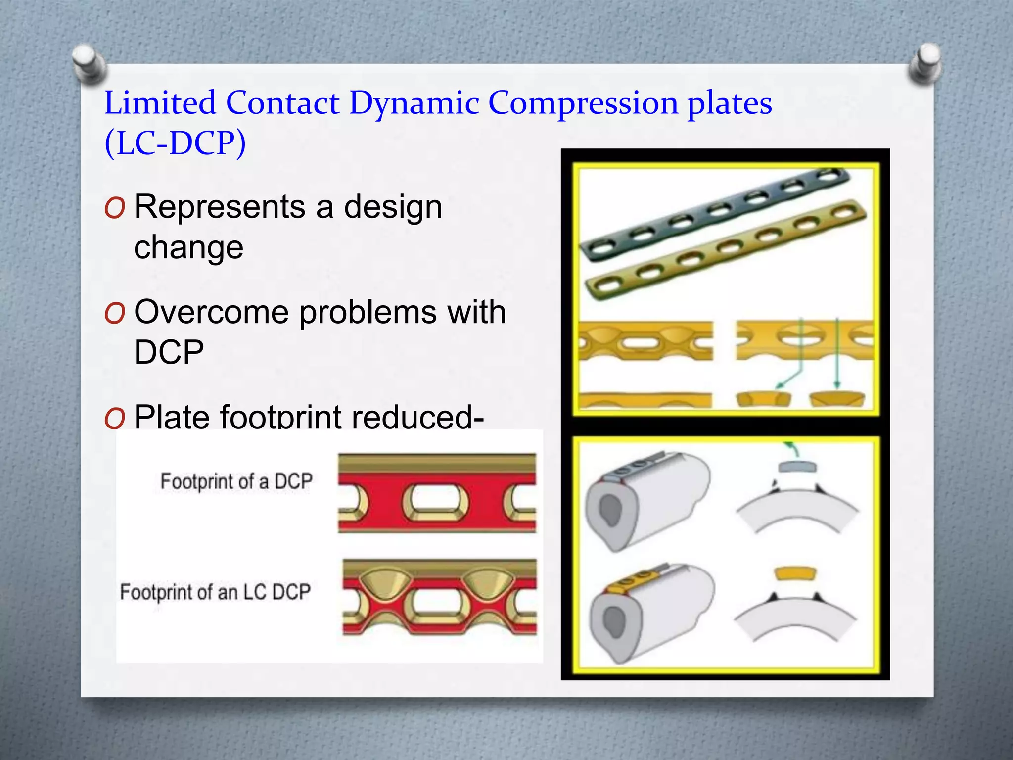Basic implant ortho | PPTX