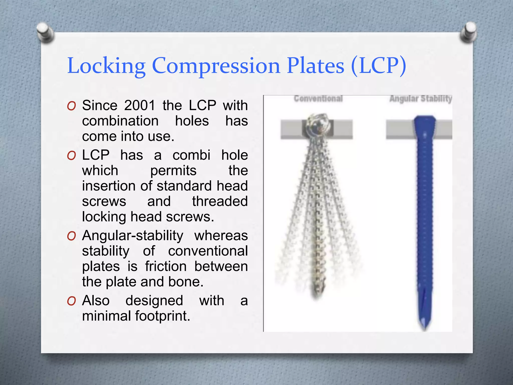 Basic implant ortho | PPTX