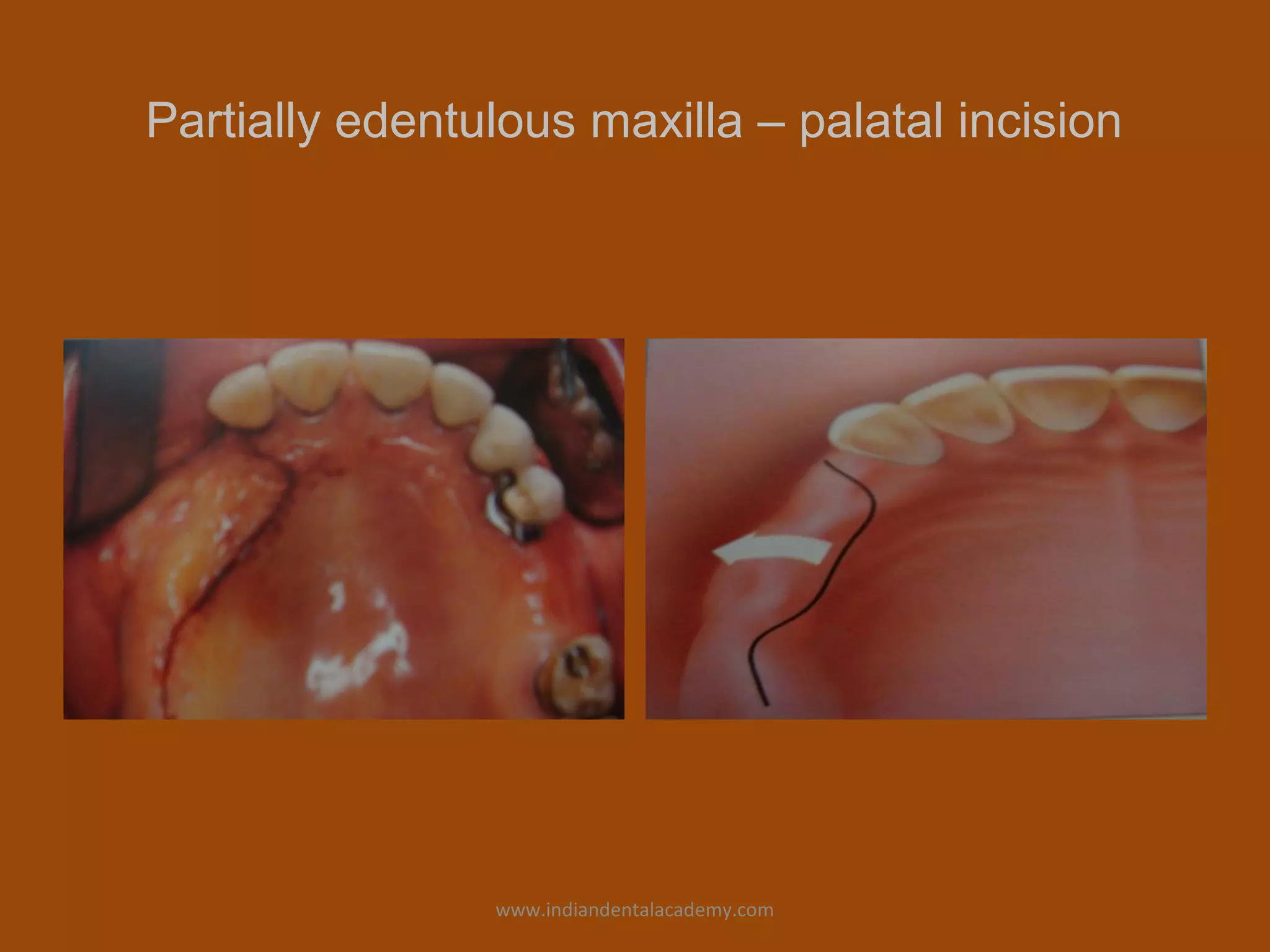 Basic dental implant surgery/ cosmetic dentistry training | PPT