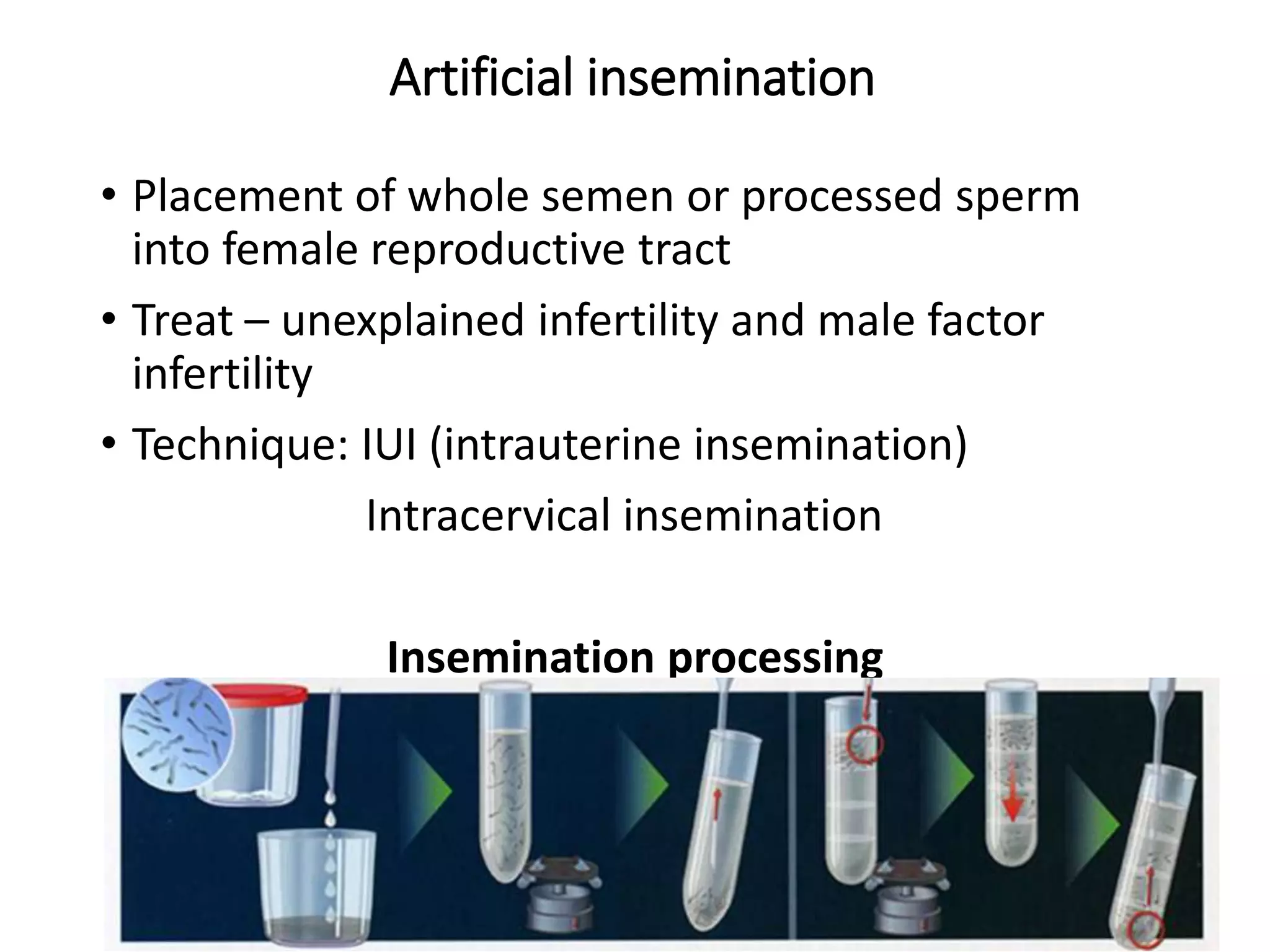 Basic infertility rx 17.02.2016