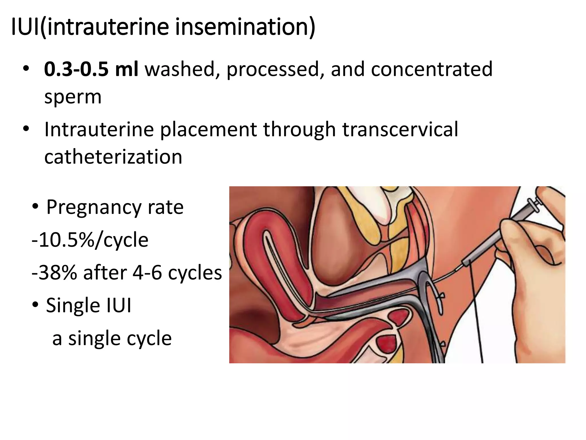 Basic infertility rx 17.02.2016