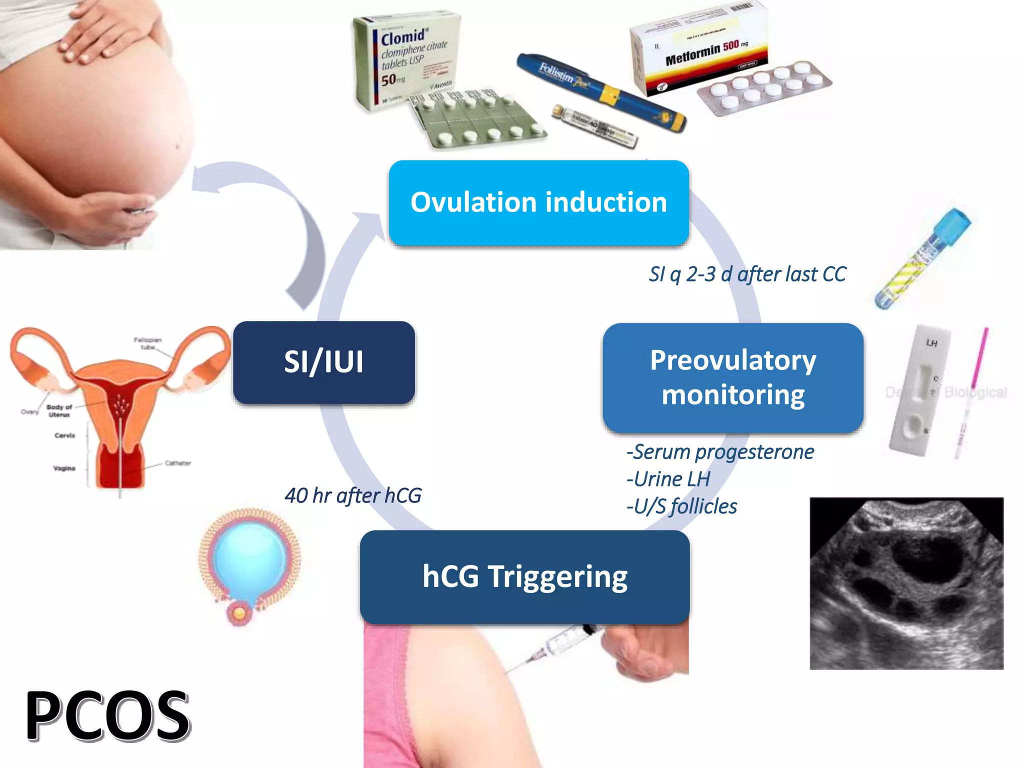 Basic infertility rx 17.02.2016