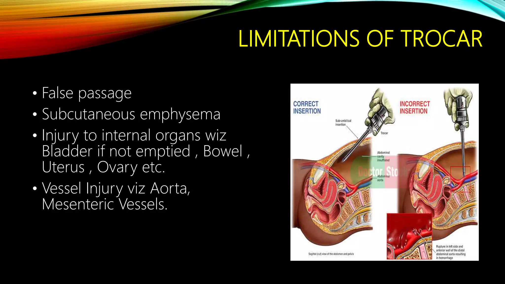 Basic instrumentation in endoscopy | PPTX