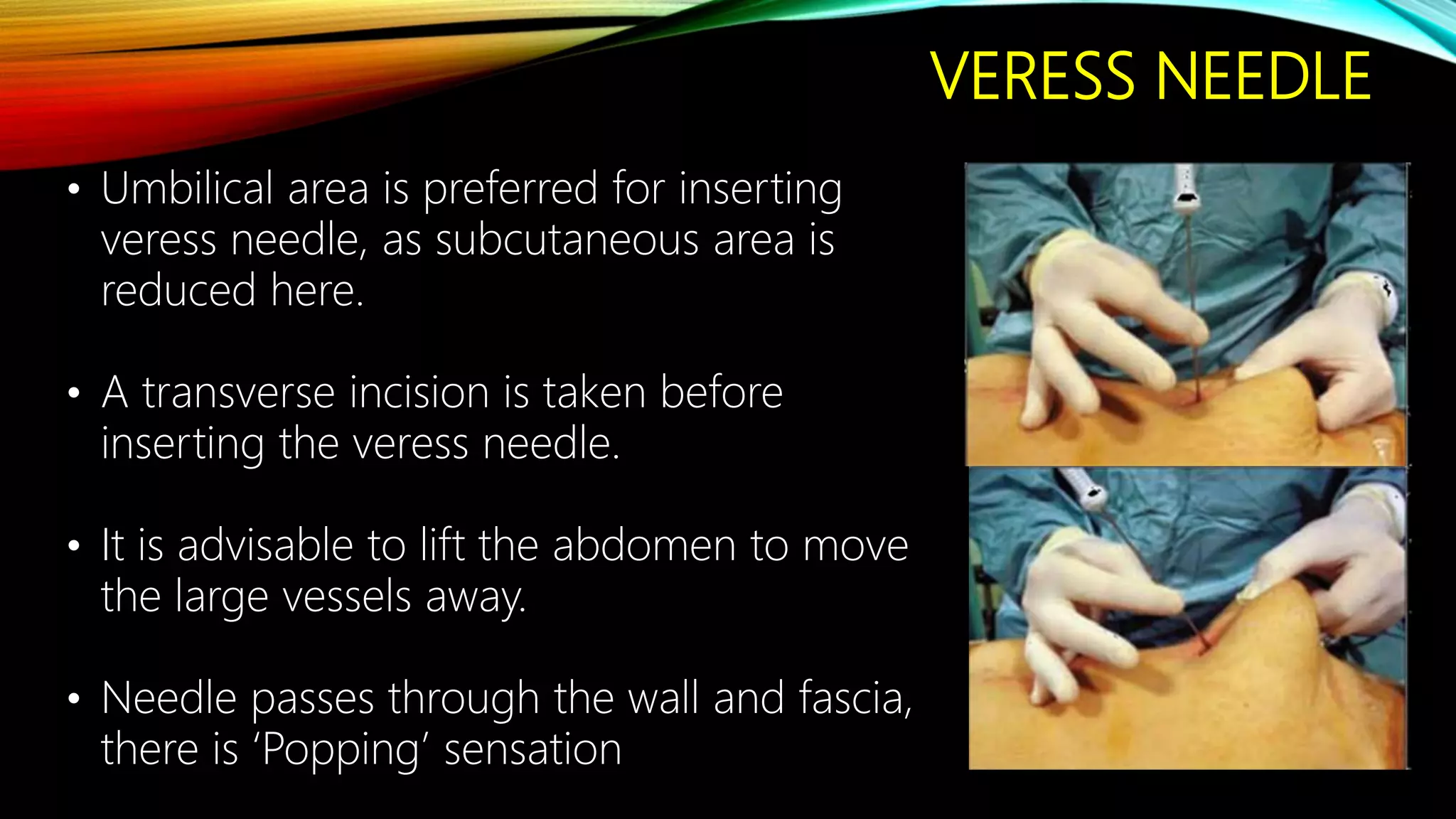 Basic instrumentation in endoscopy | PPTX