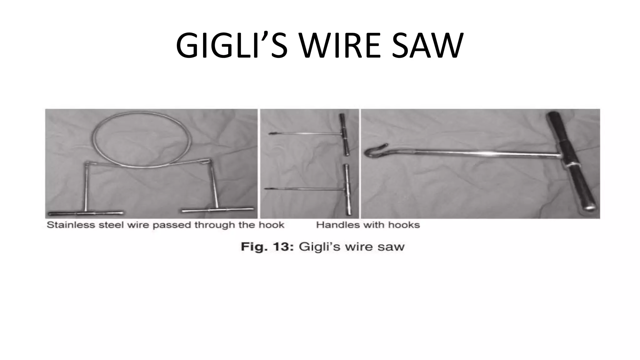 Basic instrument in orthopaedic surgery re | PPTX