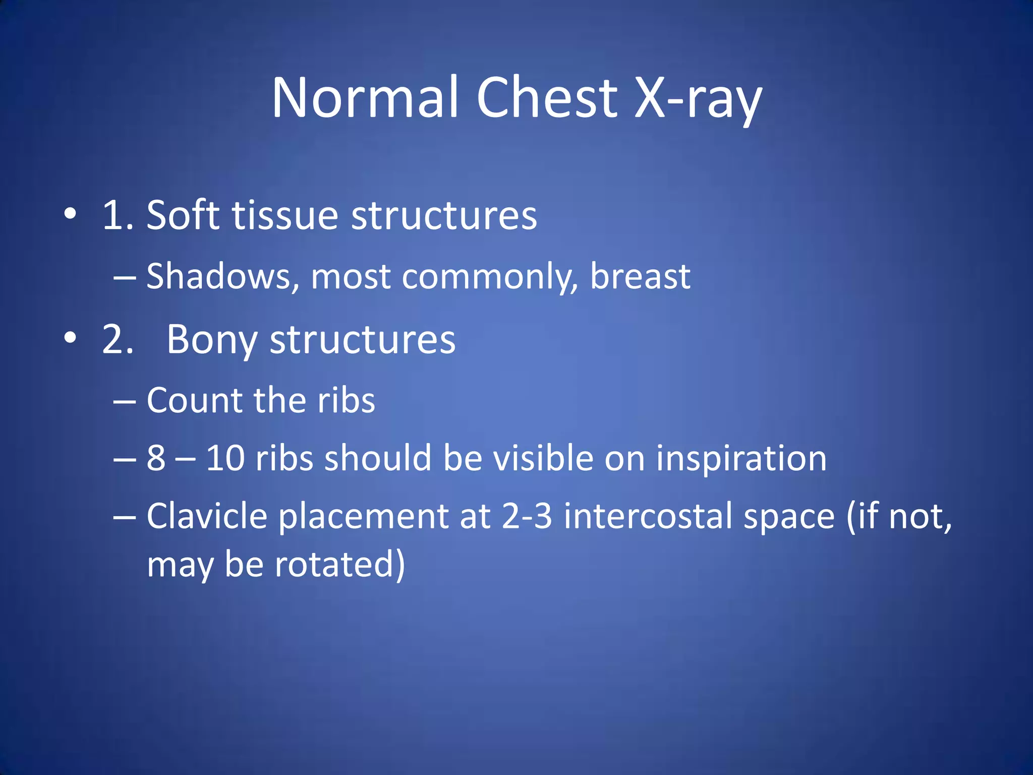 Basic interpretation of cxr | PPTX