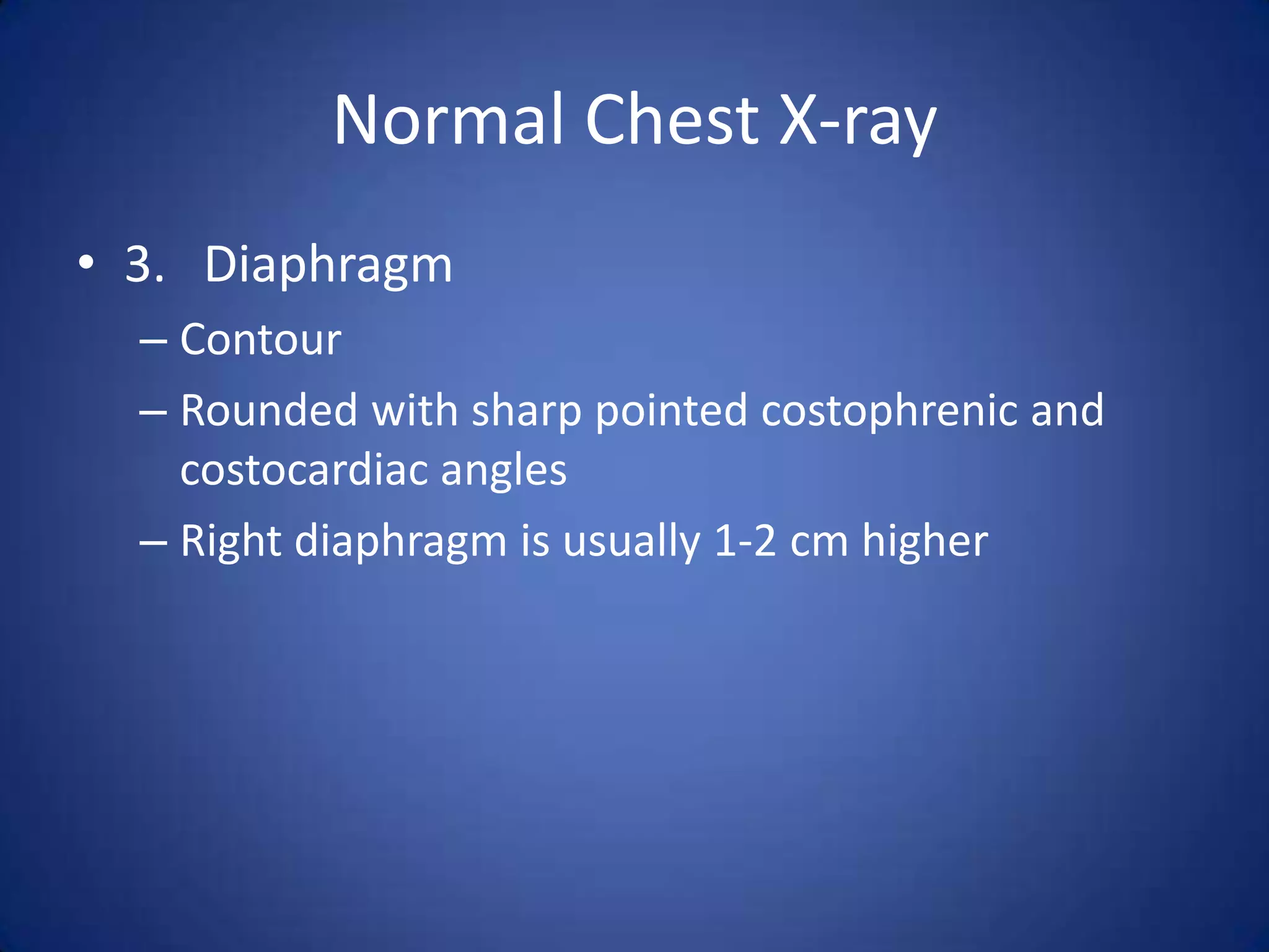Basic interpretation of cxr | PPTX