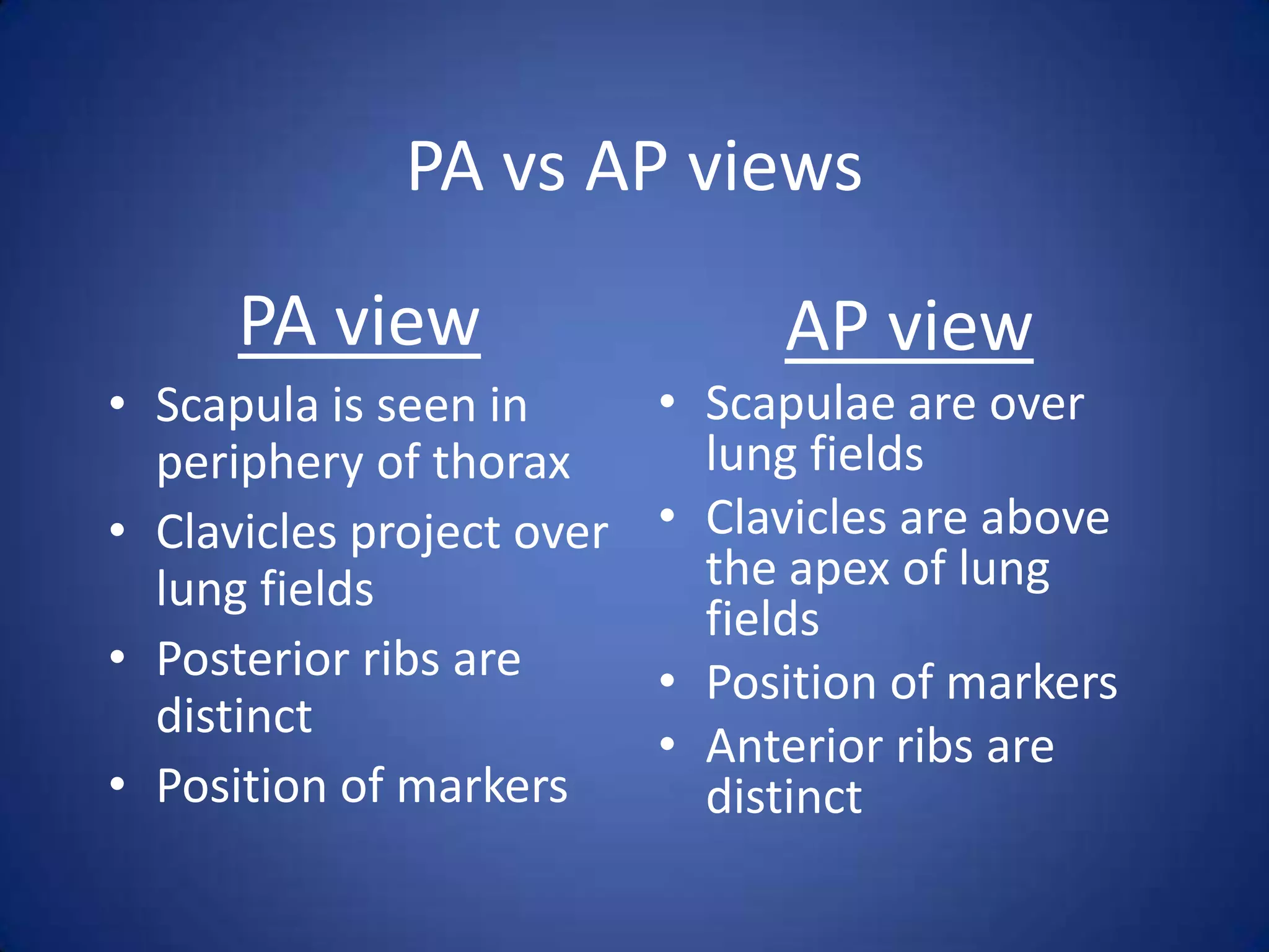 Basic interpretation of cxr | PPTX