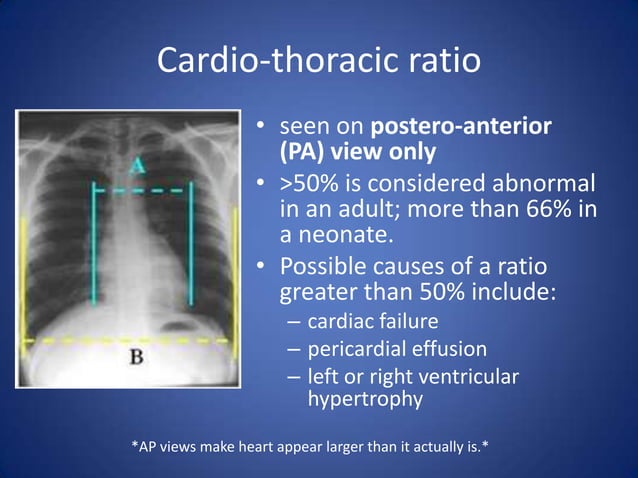Basic interpretation of cxr | PPTX | Heart and Cardiovascular Diseases ...
