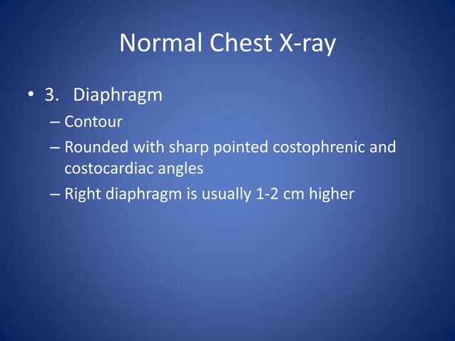 Basic interpretation of cxr | PPTX | Heart and Cardiovascular Diseases ...