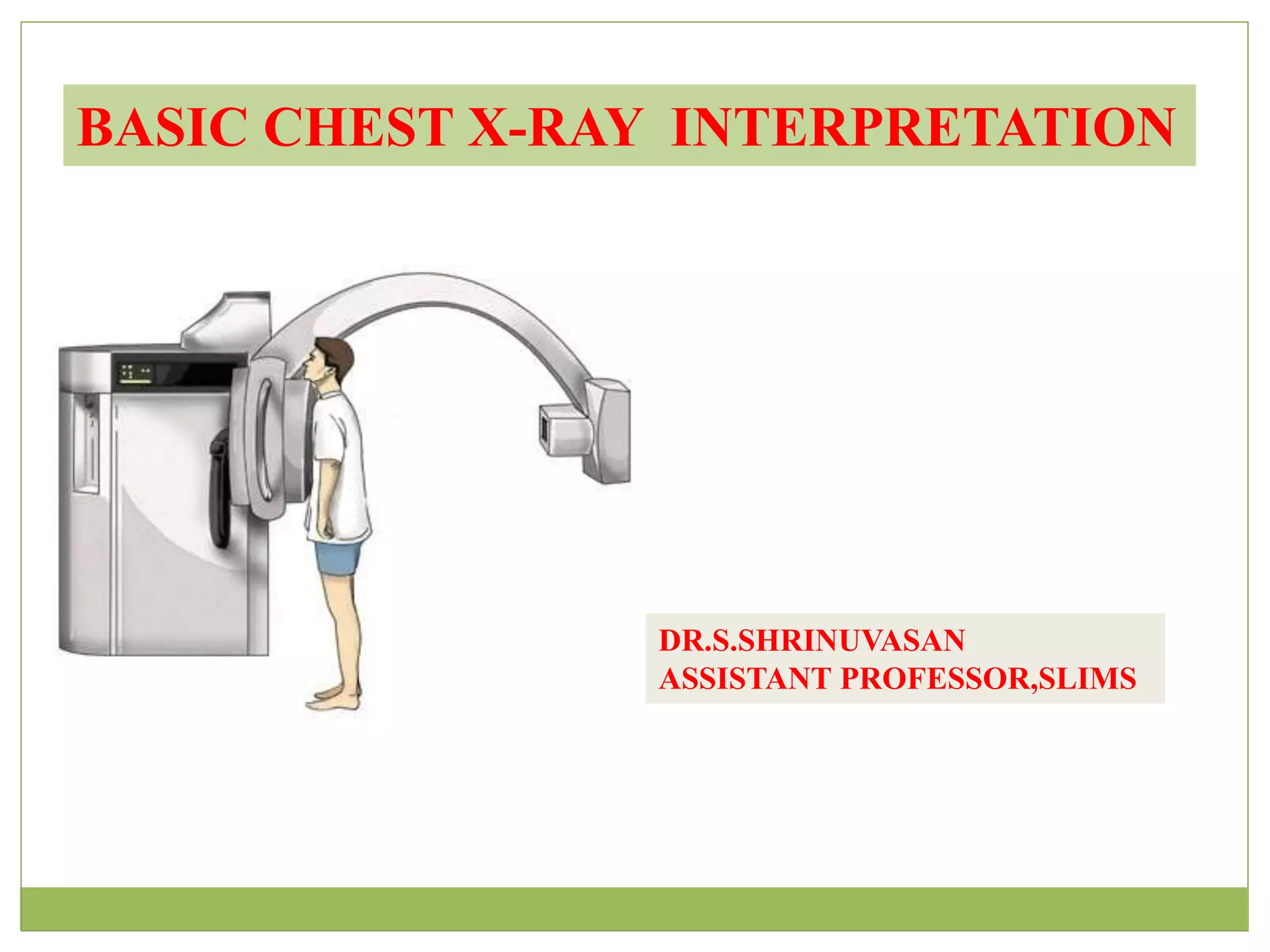 BASIC CHEST X-RAY INTERPRETATION | PPTX