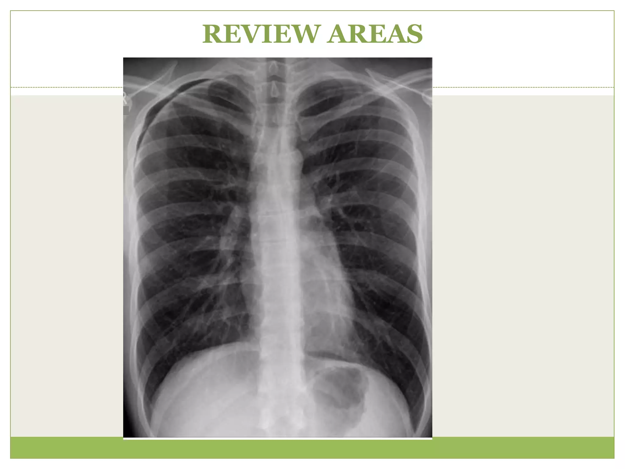 BASIC CHEST X-RAY INTERPRETATION | PPTX