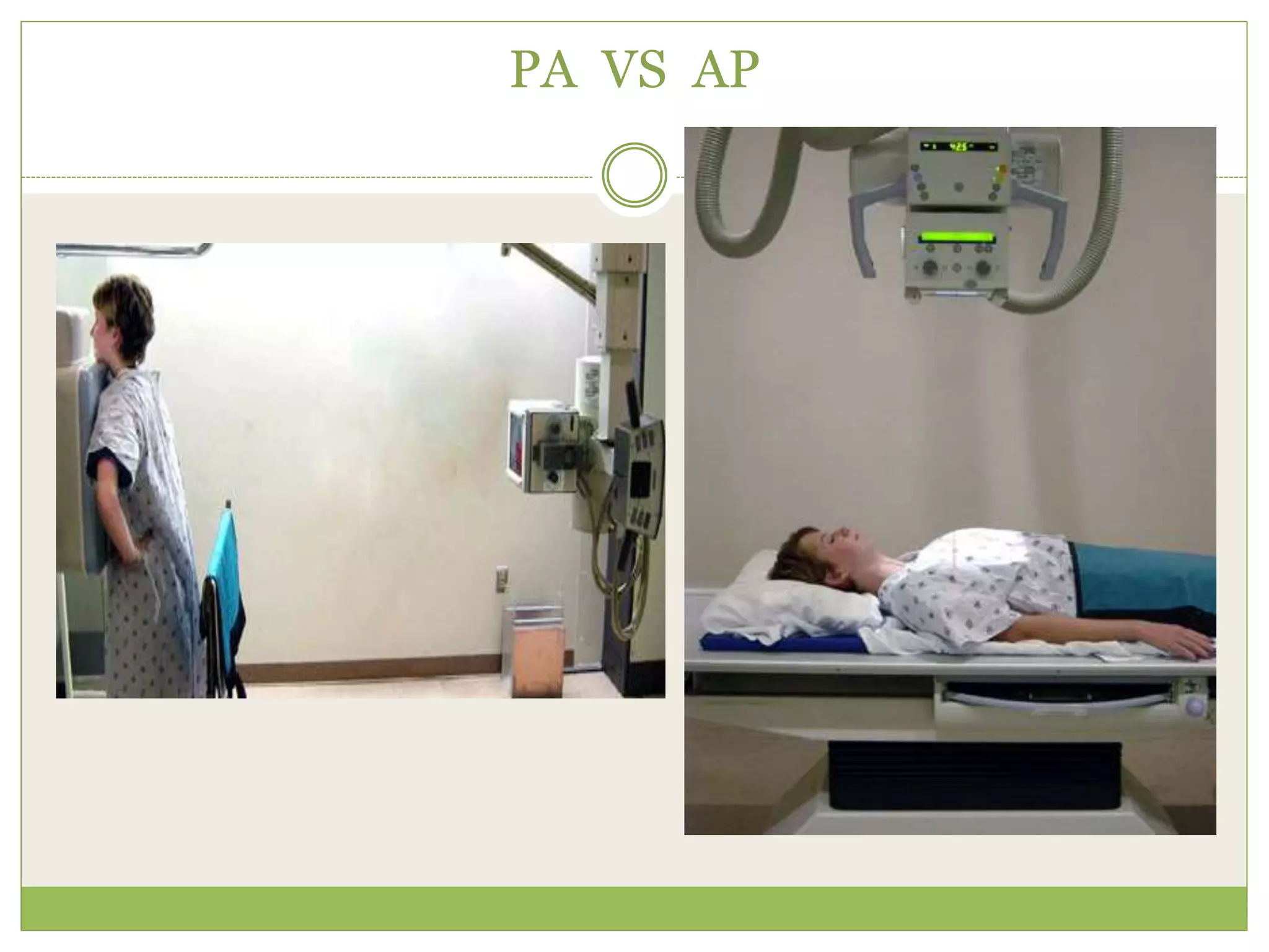 BASIC CHEST X-RAY INTERPRETATION | PPTX