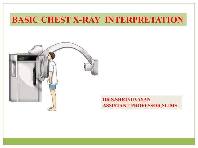 BASIC CHEST X-RAY INTERPRETATION | PPTX