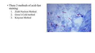 Basic introduction of microscopy with types and staining | PPTX