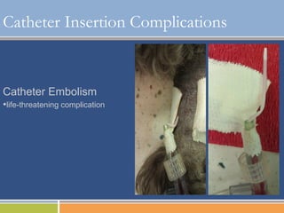 Basic IV Catheter Placement | PPT