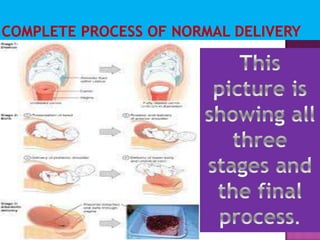 Basic knowledge about delivery process | PPTX | Pregnancy ...