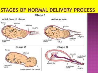 Normal Delivery Process