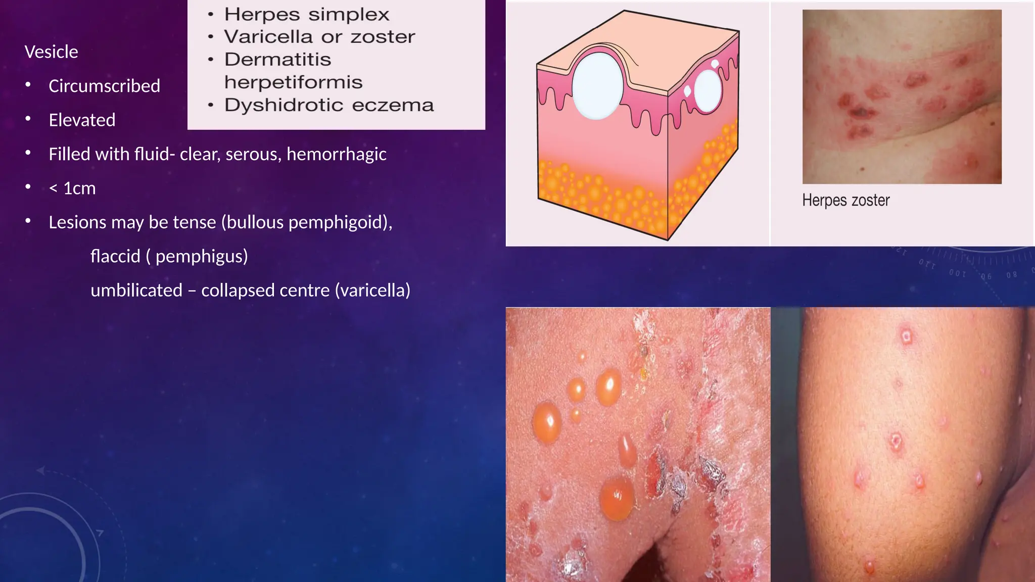 basic lesions seminar.pptx medical education | PPTX