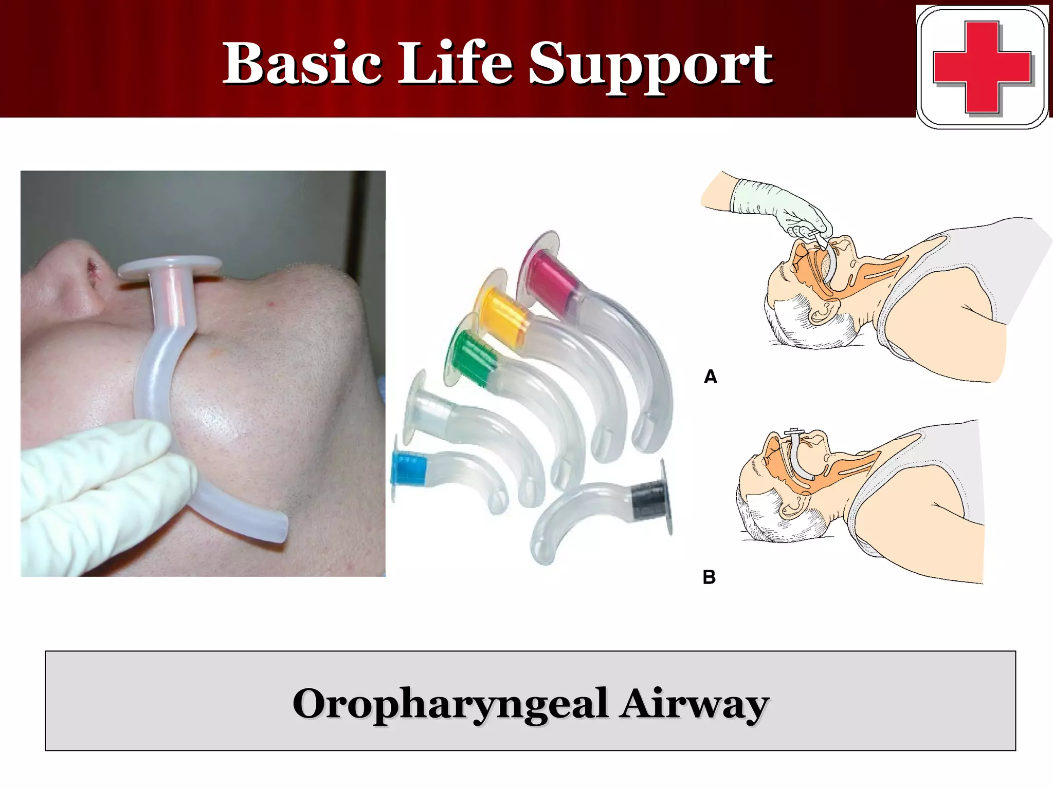 Basic life support | PPT
