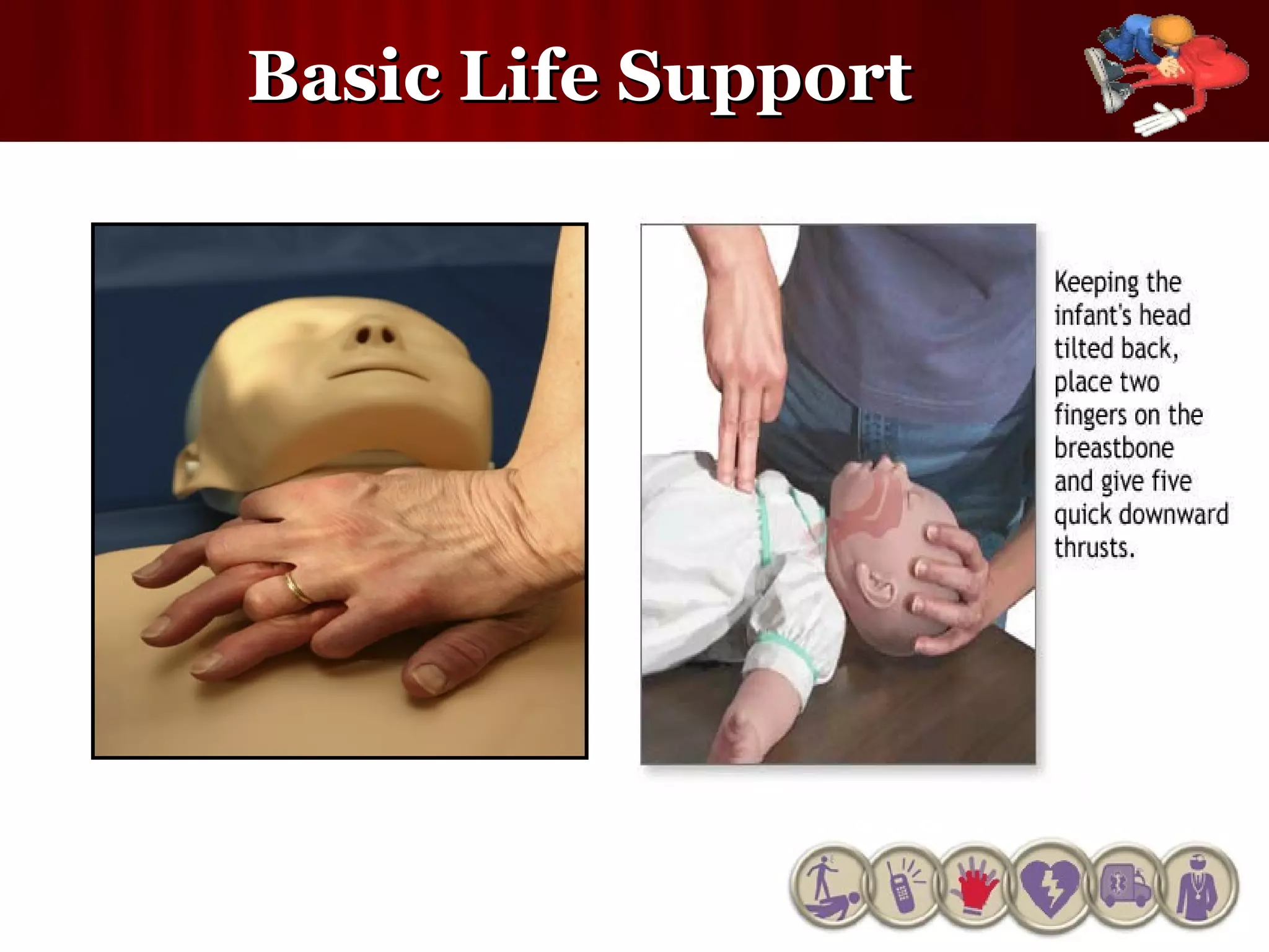 Basic life support | PPT