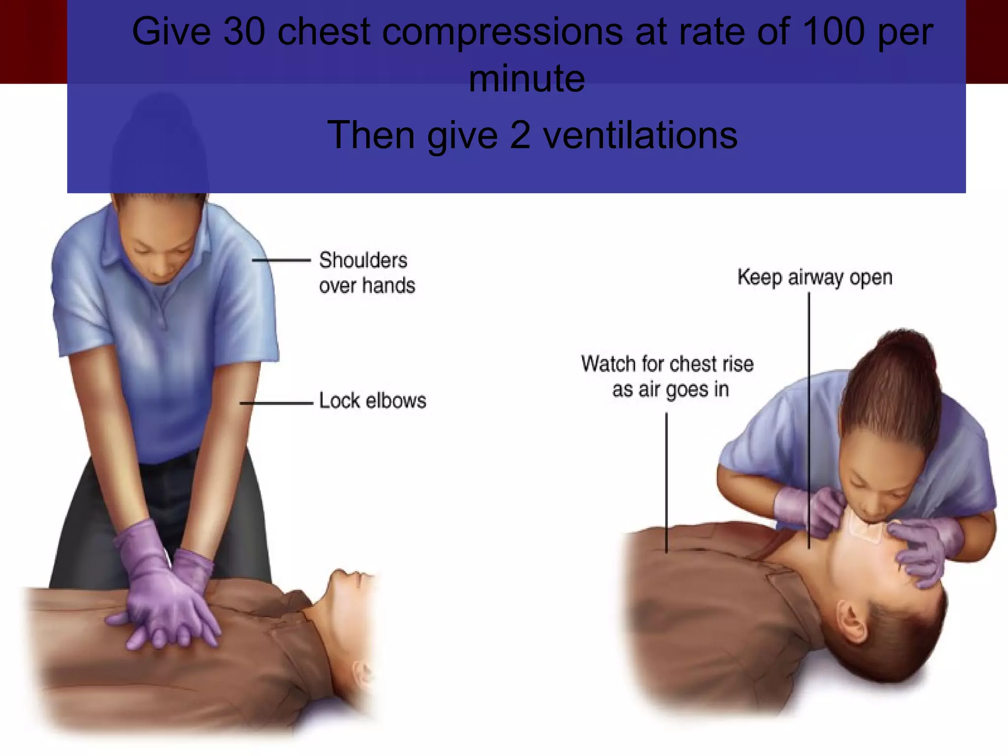 Basic life support | PPT