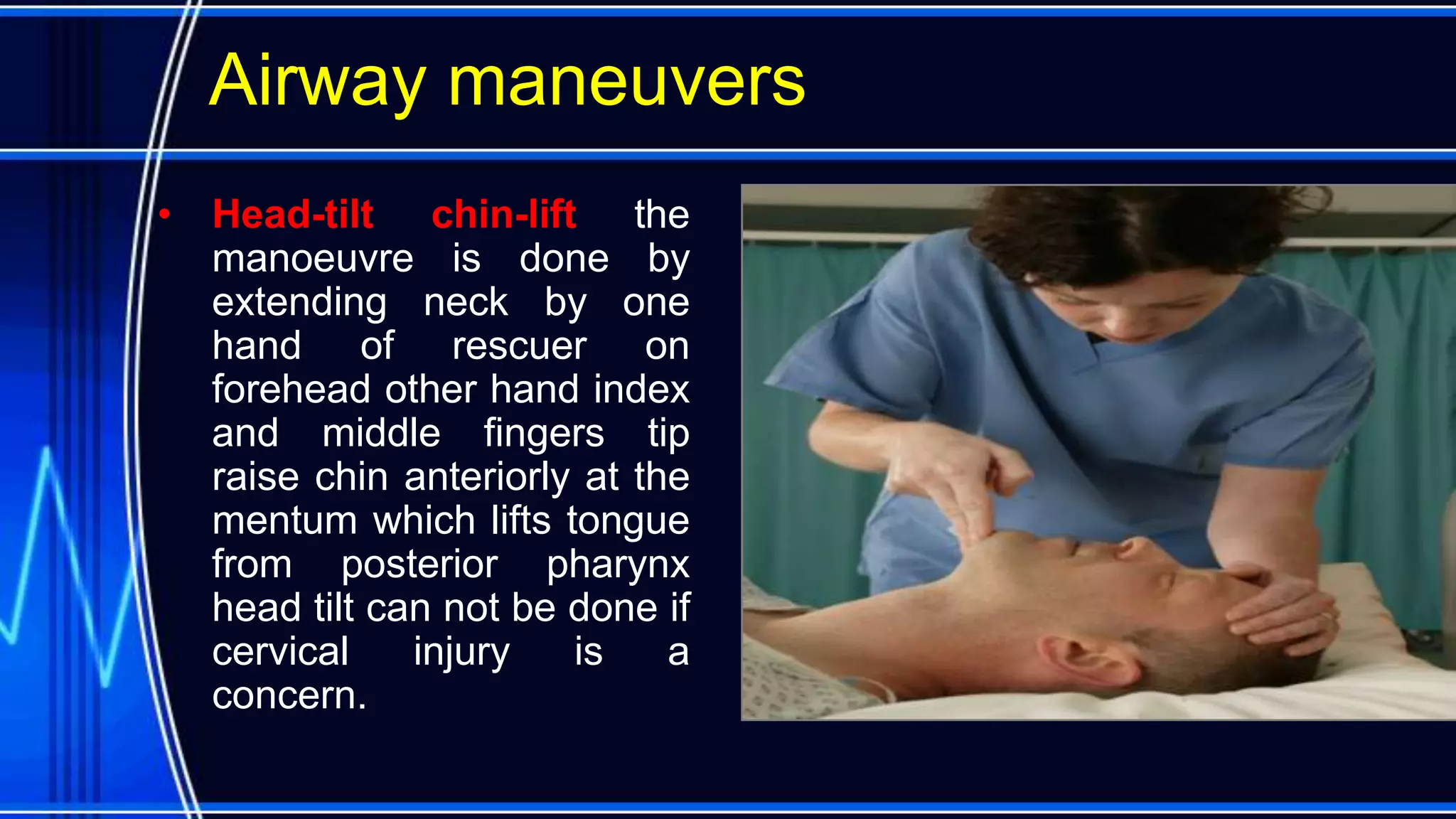 Basic life support | PPTX