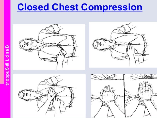 Basic Life Support (BLS)