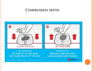 Basic life support | PPTX