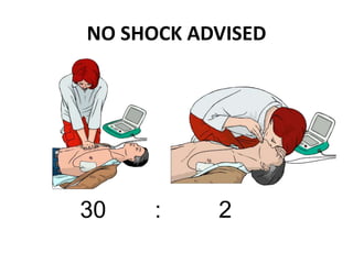 Basic life support | PPTX