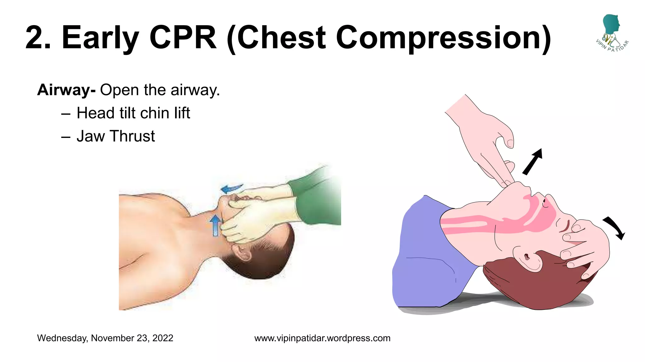 Basic life support | PPTX