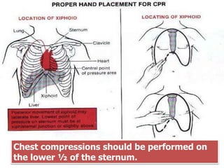 Basic Life Support.pptx