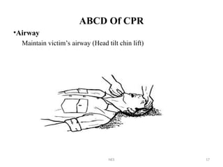 Basic life Support CPR.pptgghhhhhgggggggg | PPT