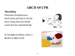 Basic life Support CPR.pptgghhhhhgggggggg | PPT