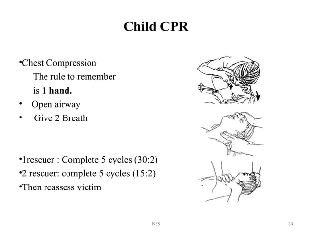 Basic life Support CPR.pptgghhhhhgggggggg | PPT