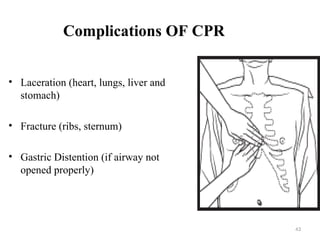 Basic life Support CPR.pptgghhhhhgggggggg | PPT