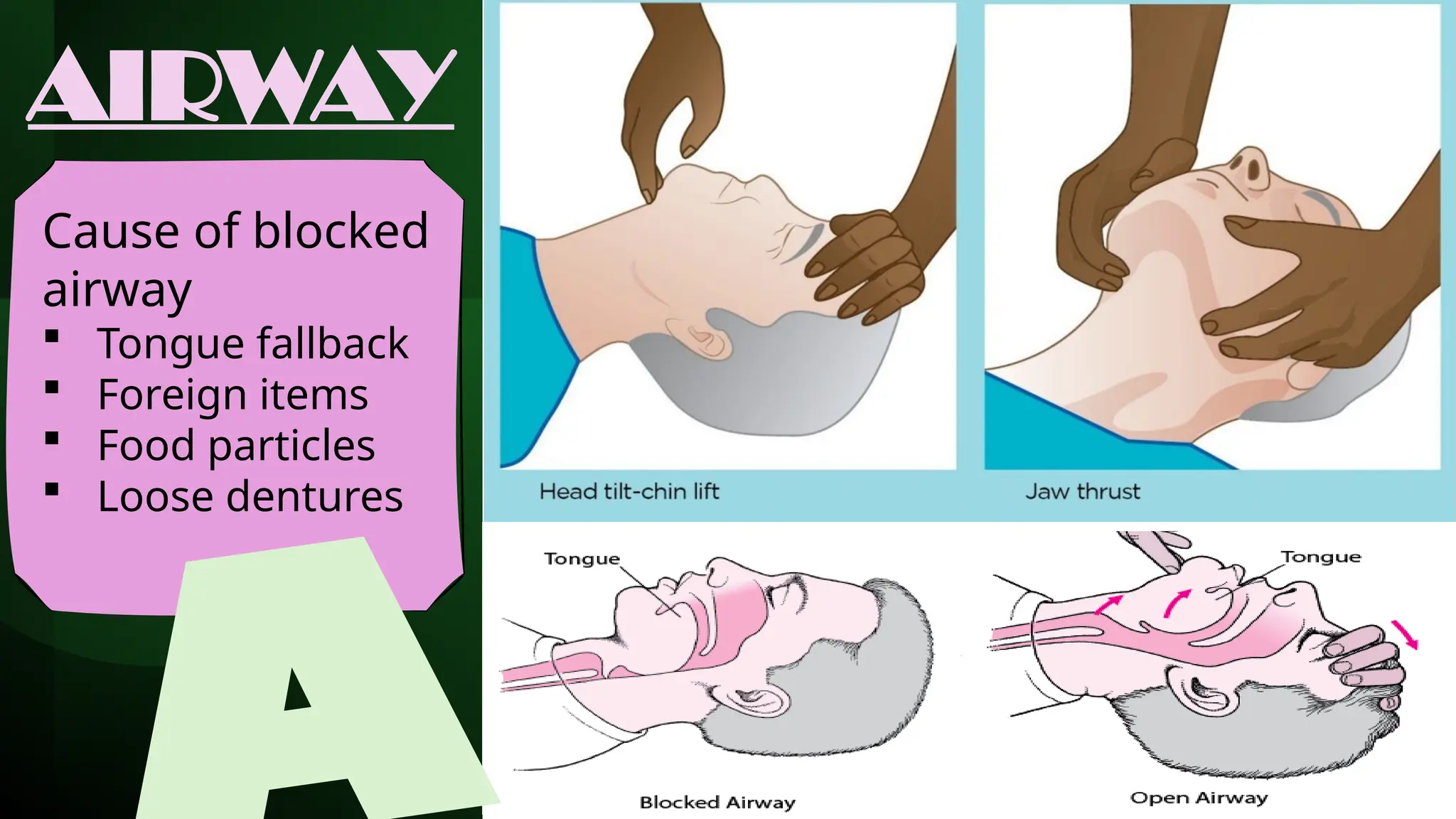 BASIC LIFE SUPPORT presentation final.pptx