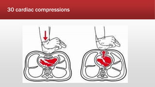 Basic Life Support ppt.pptx