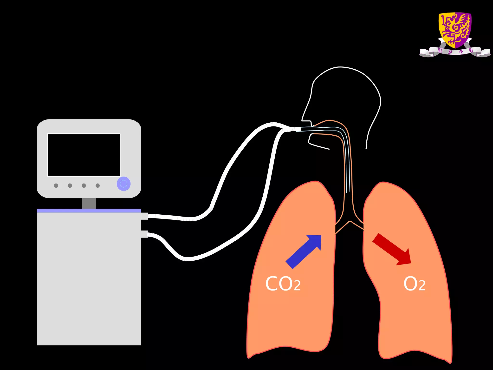 Basic Mechanical Ventilation | PPT